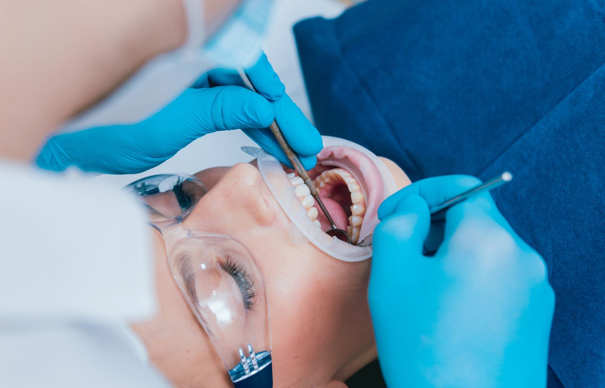 Restorative Rates: How Much Do Root Canals Cost? | Carlson Dental Group